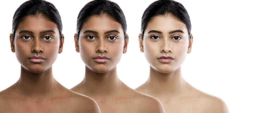 What are the different types of skin lightening treatments available?